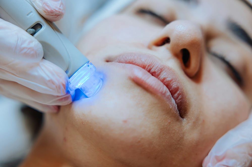 Lasting Impressions Laser Body Sculpting